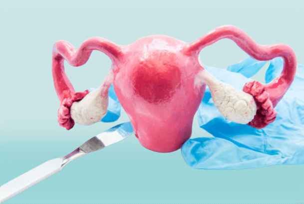 How To Lose Belly Fat After Tubal Ligation - My Mama & Me